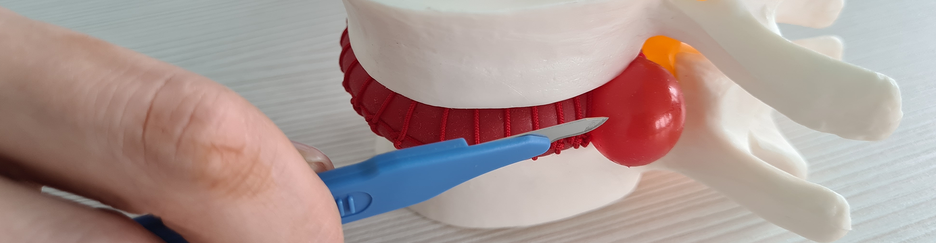 Prolapsed Intervertebral Disc: Symptoms, Causes, Risk, & Prevention
