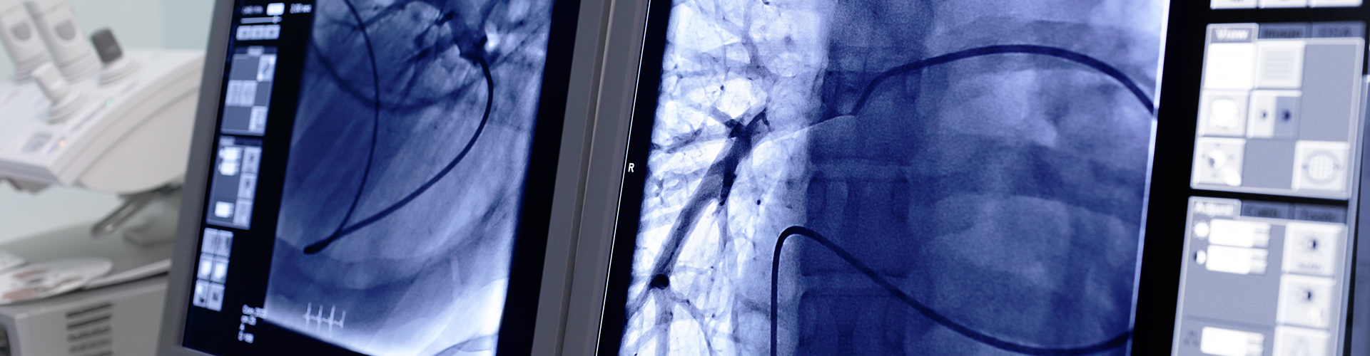 Pleural Biopsy - Uses, Purpose, Procedure, Benefits and Risks | Medanta