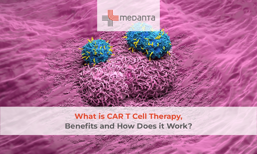 What is CAR T Cell Therapy, Benefits and How Does it Work? | Medanta