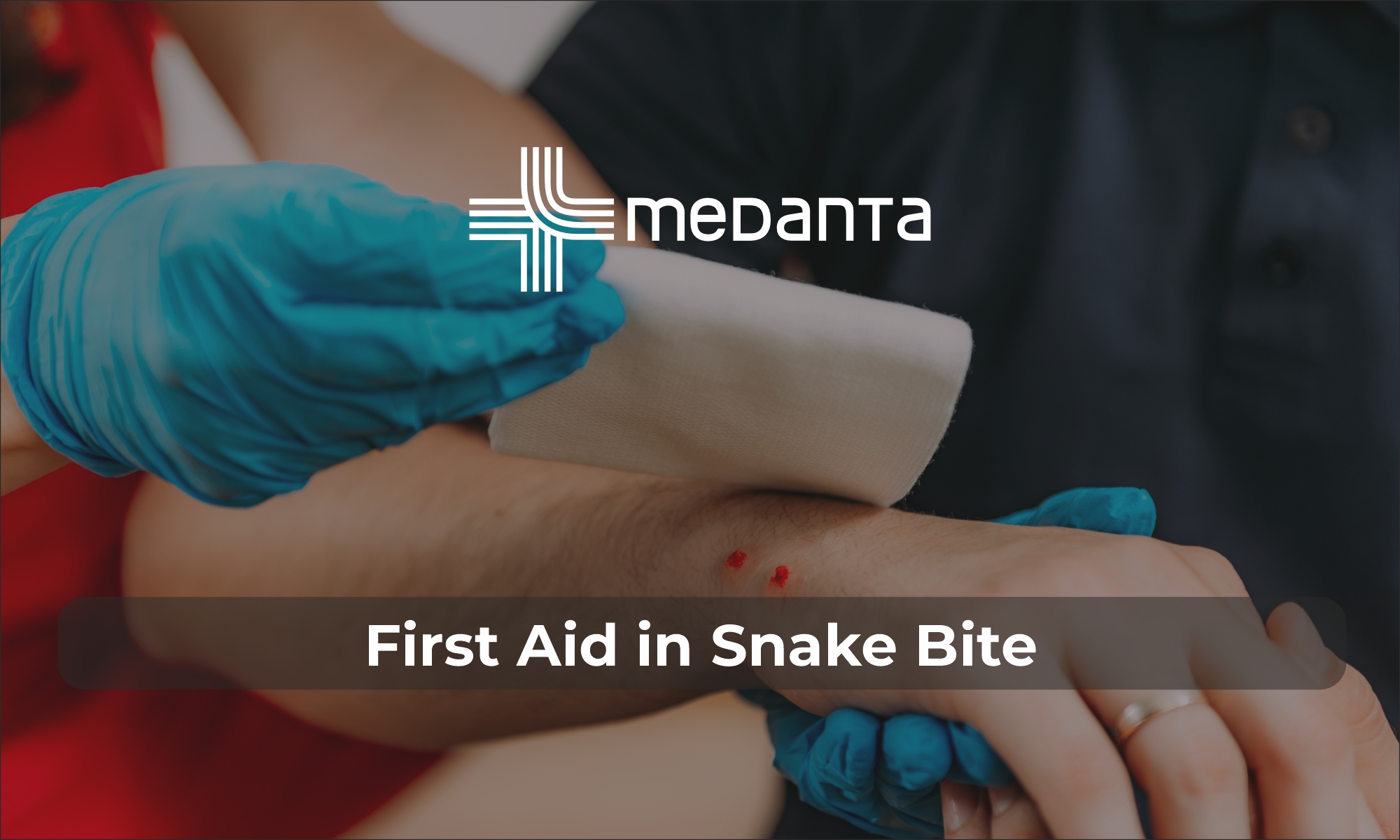 How to Administer First Aid for Snake Bites the Correct Way? | Medanta