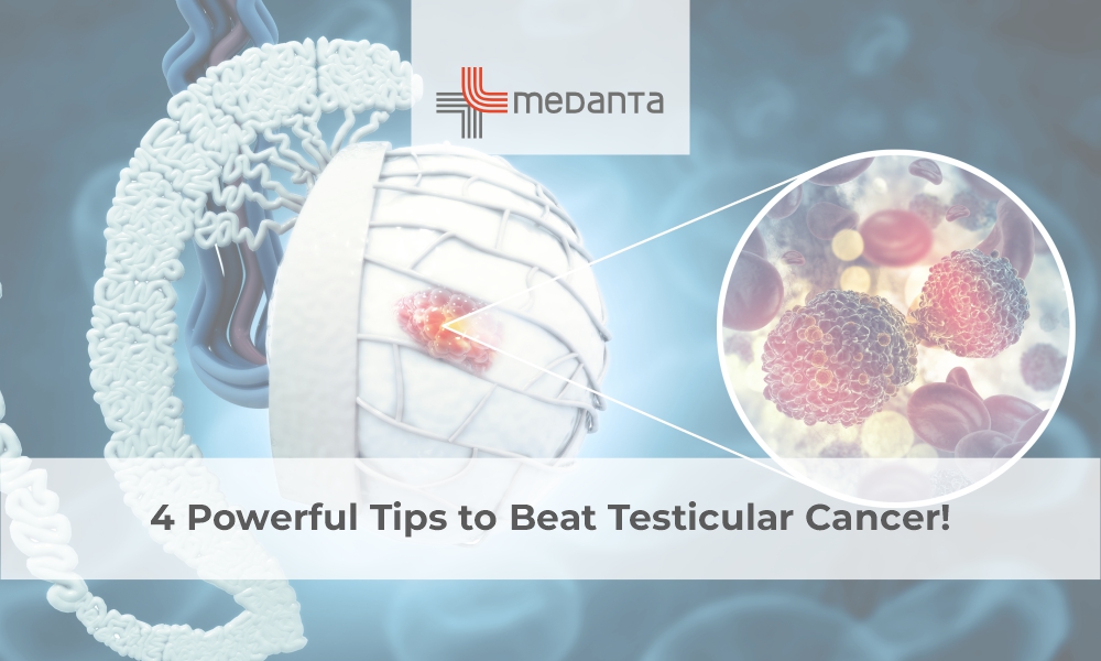 Beat Testicular Cancer with Timely Diagnosis and Advanced Treatment ...