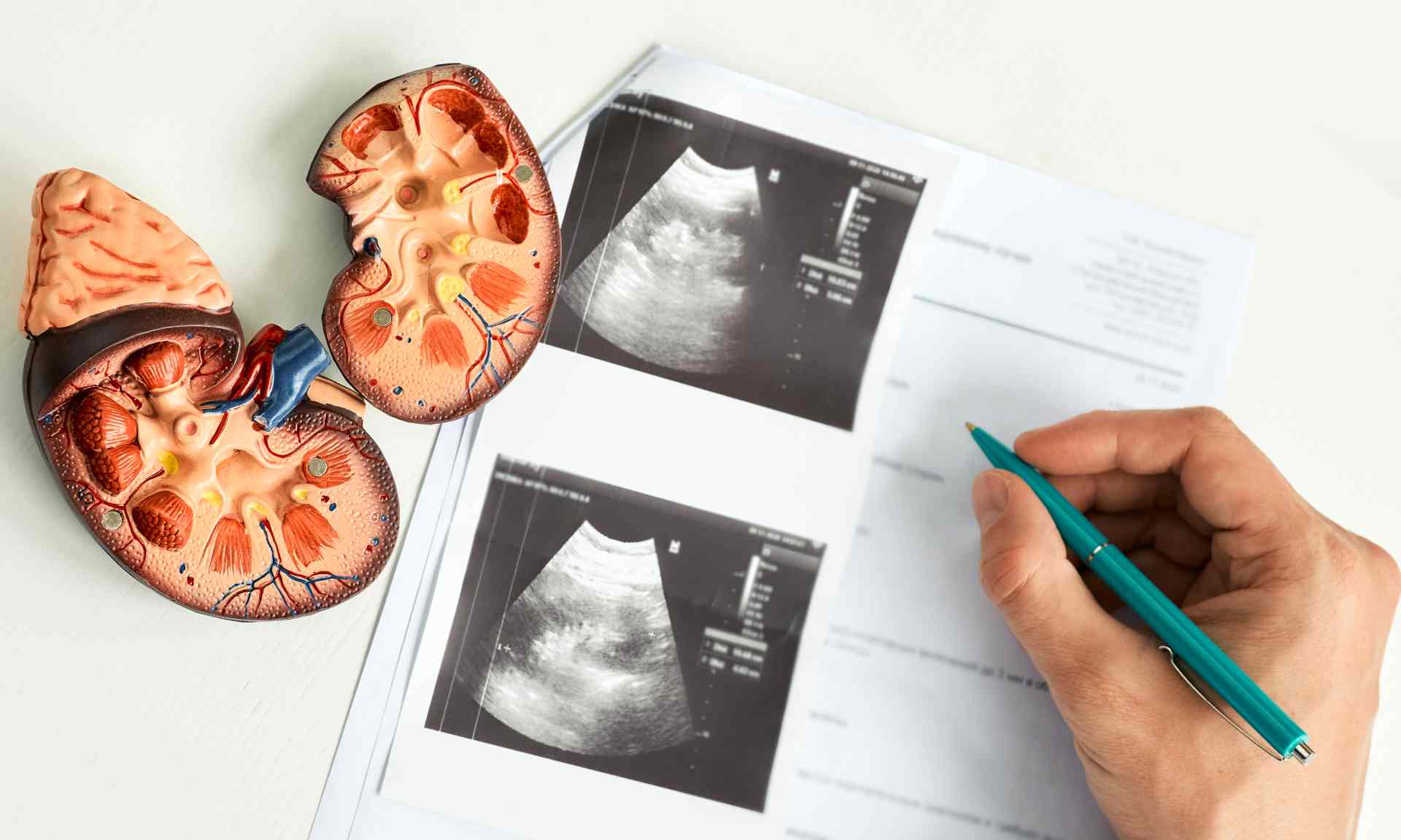 Renal DTPA Scan Treatment for Kidney in India | #site_title