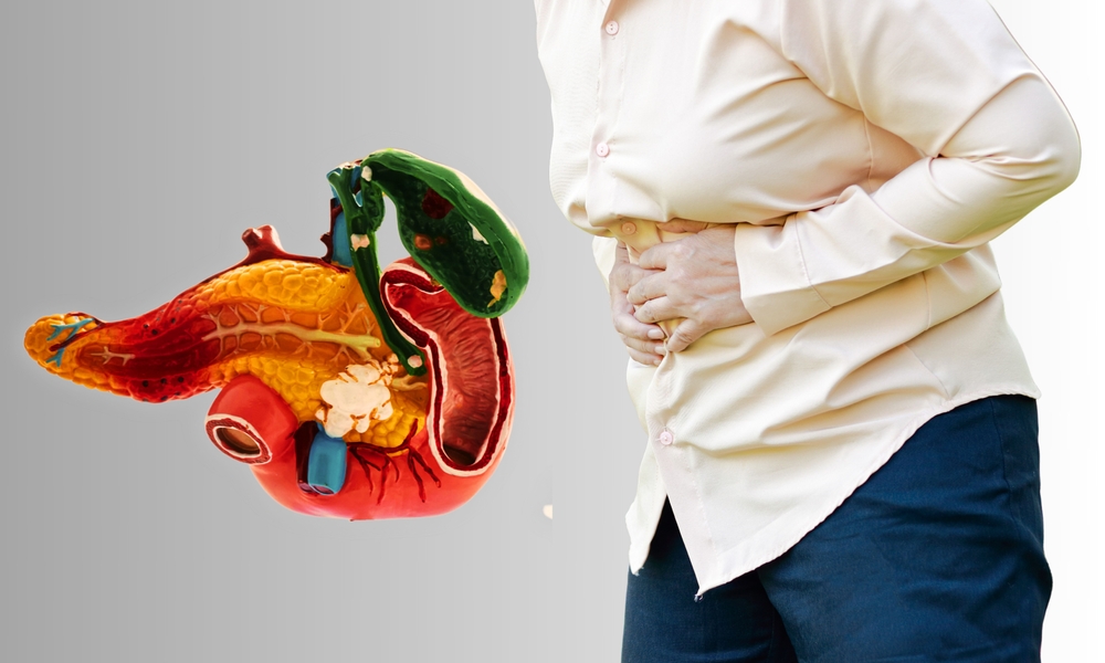 Biliary Disease: Symptoms, Causes, Risk, & Prevention