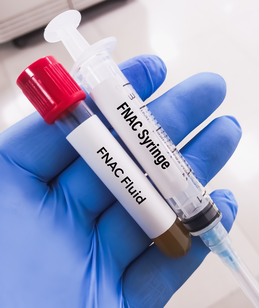 Best Internal Medicine Services & Treatments for Better Health