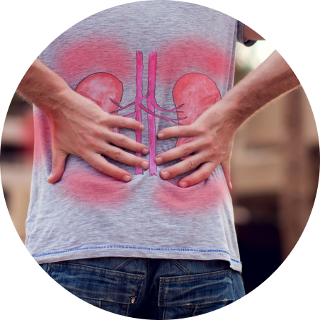 Acute Kidney Injury: Symptoms, Causes, Risk, & Prevention